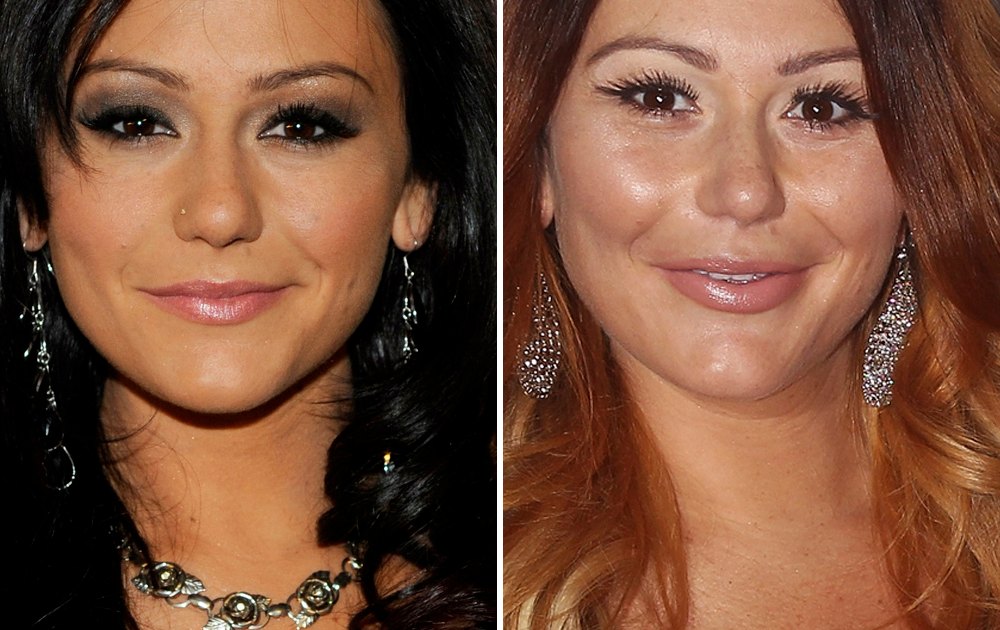 Celebrities Who Looked Way Better Before Plastic Surgery - Life & Style ...