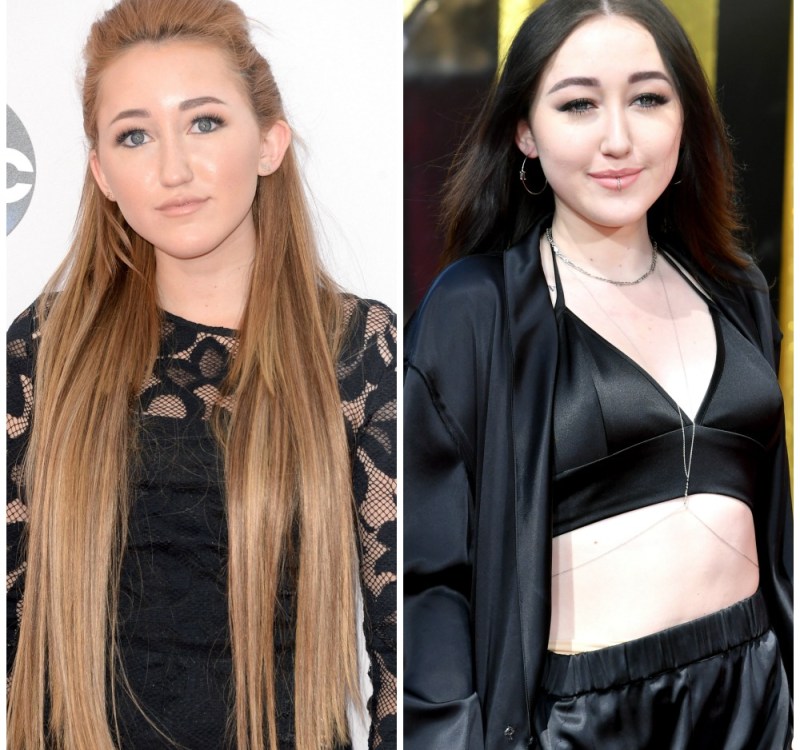 Noah Cyrus Reignites Plastic Surgery Rumors At 2017 Mtv Movie Tv Awards
