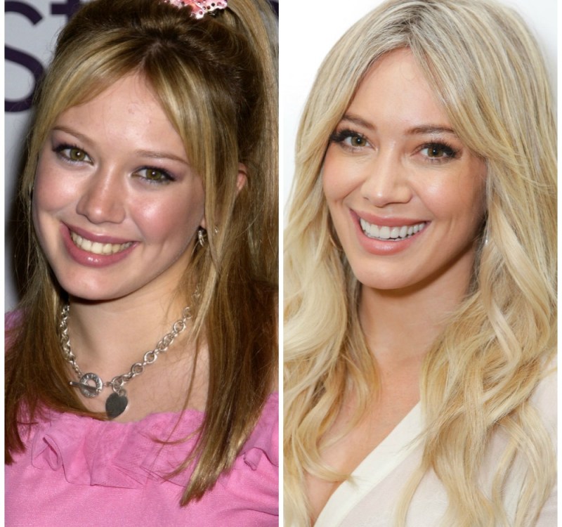Plastic Surgery? Hilary Duff Reveals Secret to Age-Defying Glow!