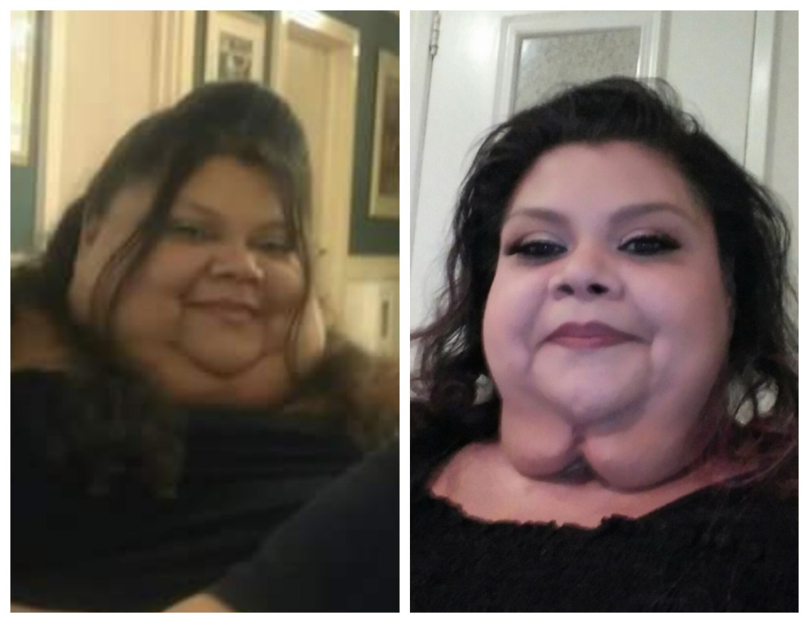 'My 600-Lb Life' Star Lupe Donovan's Before and After Photos Are ...