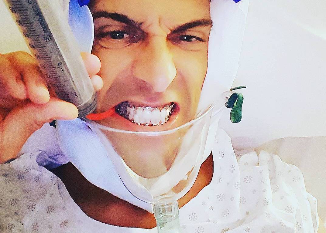 Broken Jaw Wired Shut