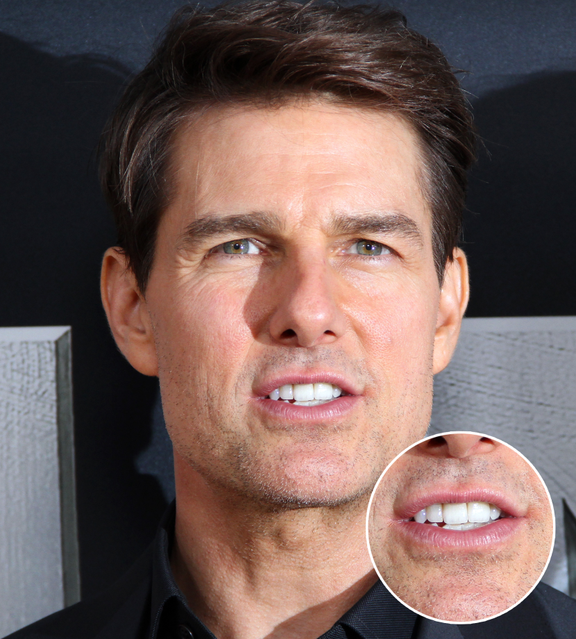 Tom Cruise's Middle Tooth — the Story Behind His Smile