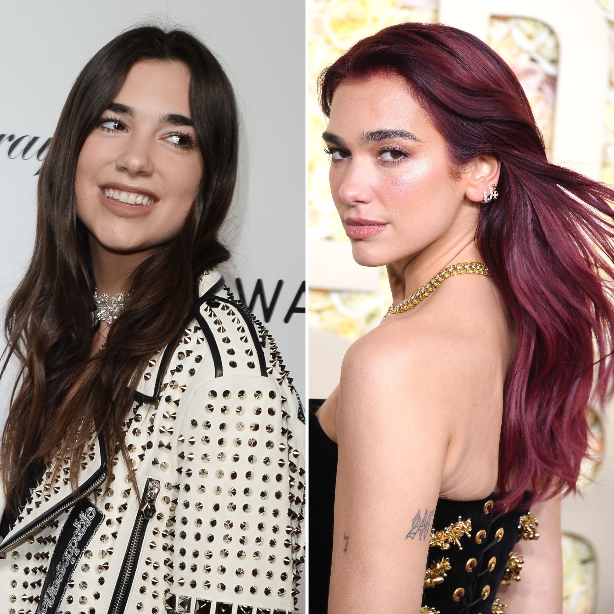 Did Dua Lipa Get Plastic Surgery? Transformation Photos | Life & Style