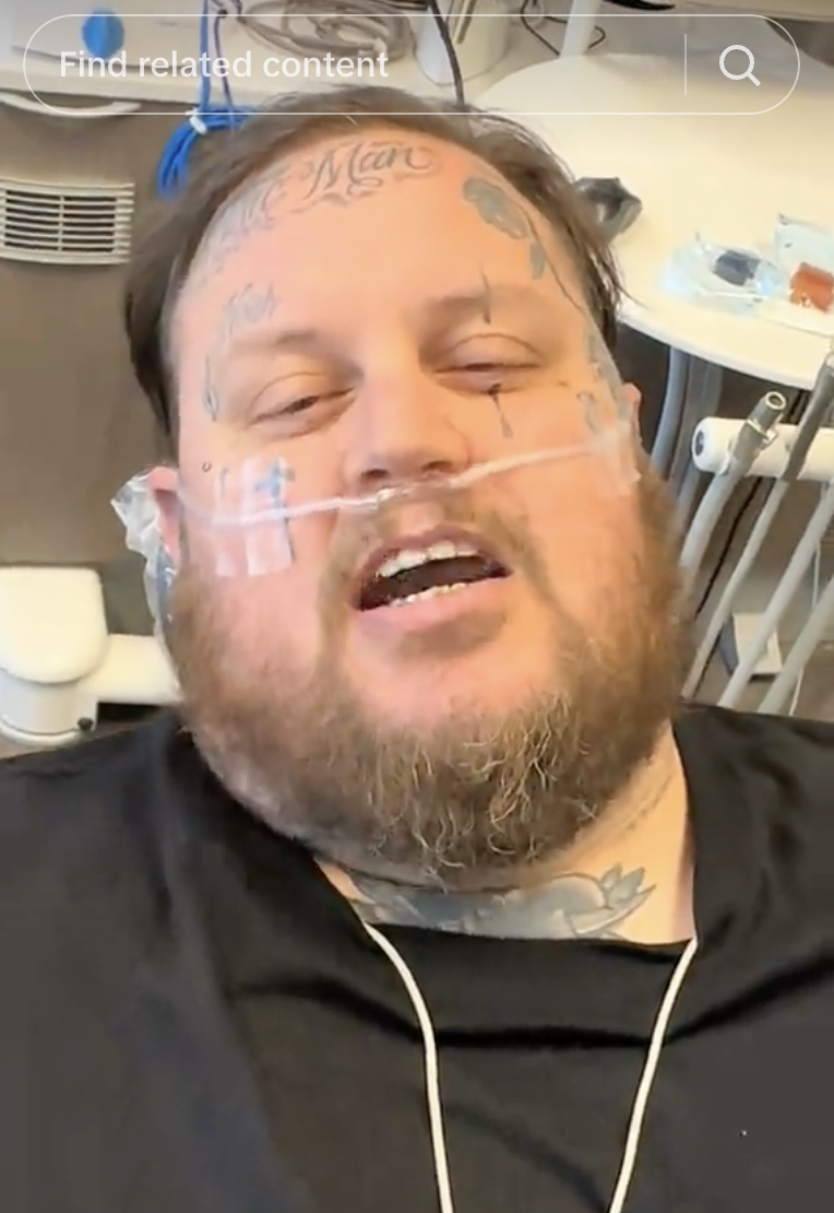 Jelly Roll Gets His Teeth Redone in 'Reconstructive Surgery' | Life & Style