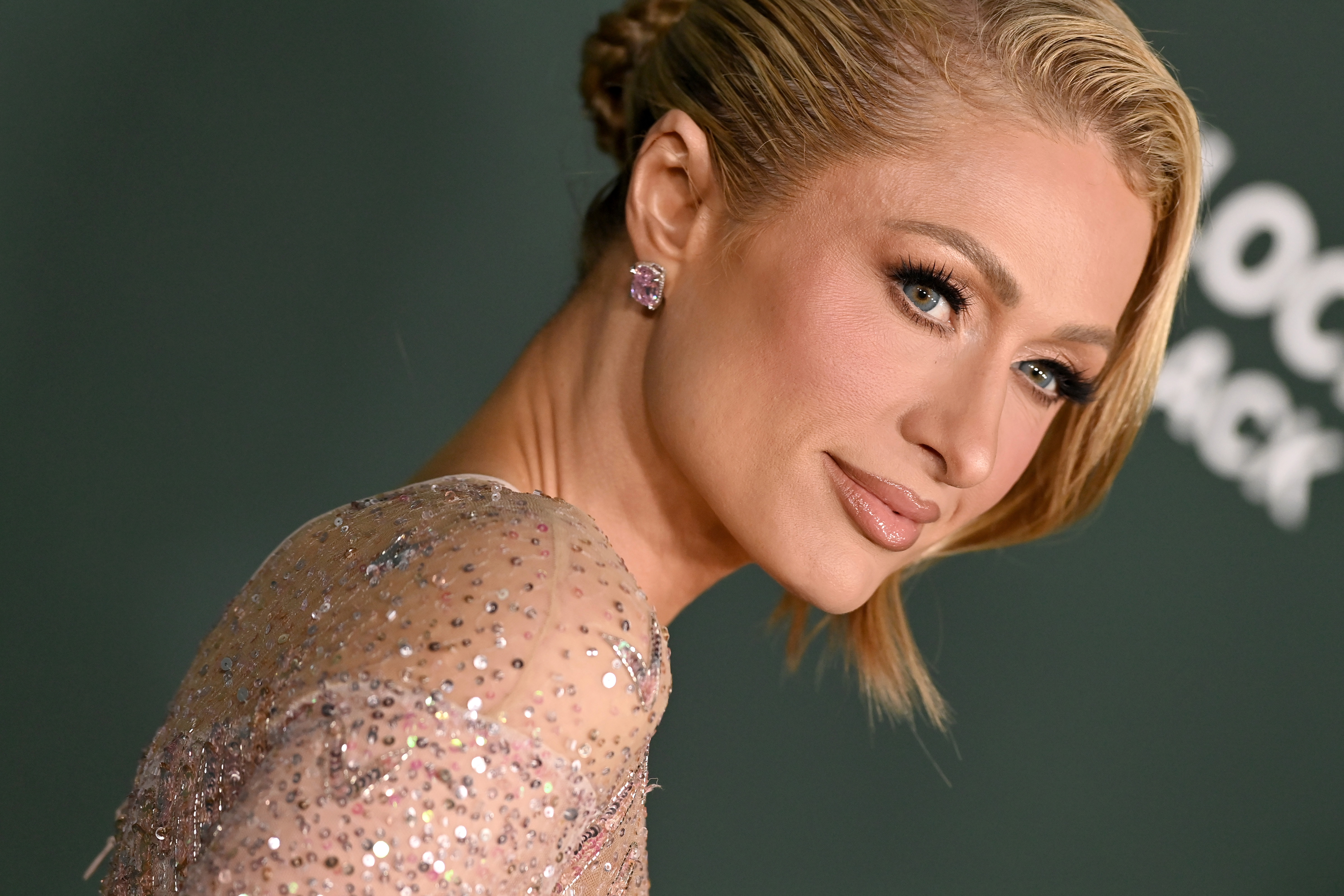Paris Hilton Reveals Which Cosmetic Procedures She’s Had | Life & Style